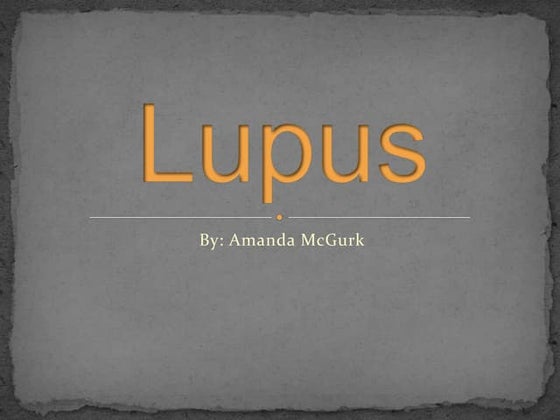 Mononucleosis matthews | PPTX