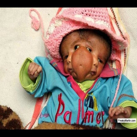 Amazing Two Headed Babies | PPS