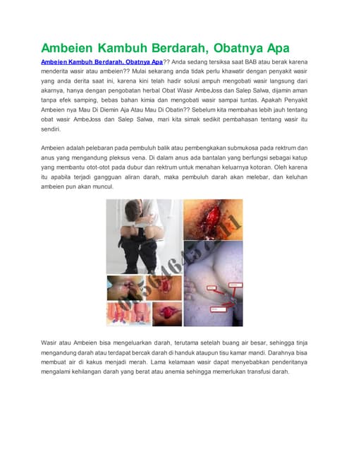 Wasir masih kecil apa perlu di operasi | PDF
