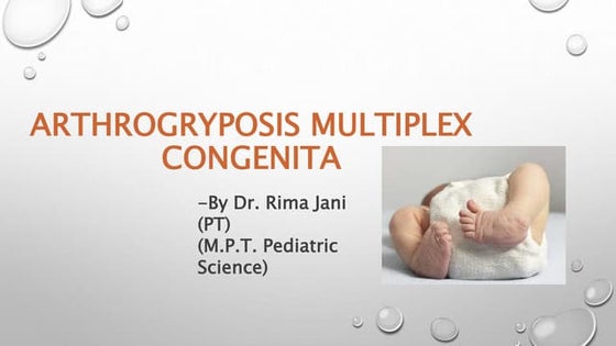 Arthrogryposis multiplex congenita | PPT