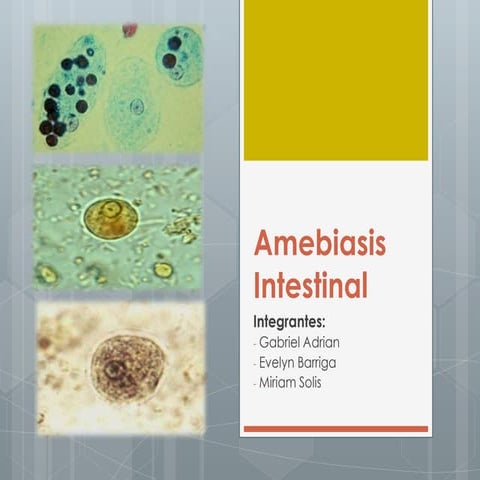 Amebiasis | PPTX
