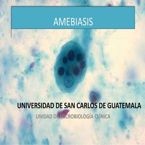 Amebiasis (1).pptx