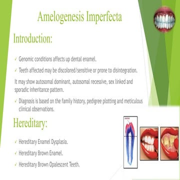 Amelogenesis imperfecta | PPTX