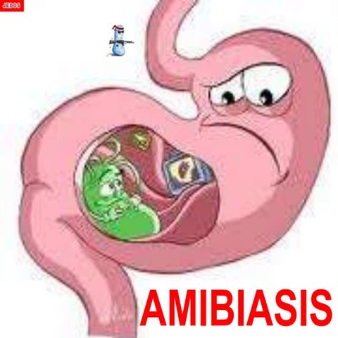 Amibiasis | PPTX