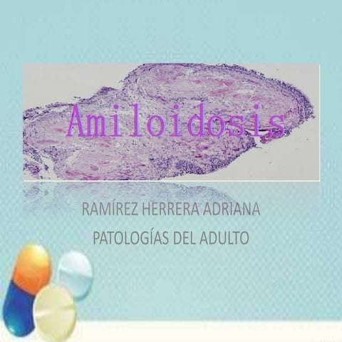 Amiloidosis | PPTX