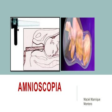 Amnioscopia | PPTX