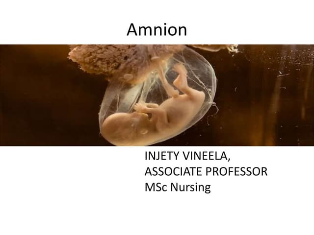 Fetal Membranes, Amniotic Cavity and Amniotic Fluid | PPTX