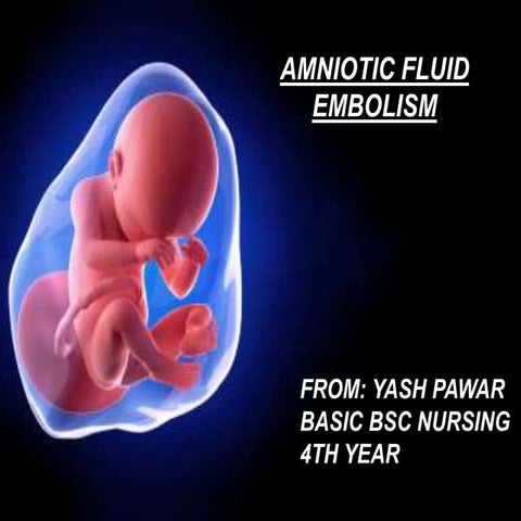 Fetal Membranes, Amniotic Cavity and Amniotic Fluid | PPTX