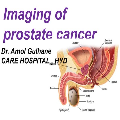 Prostate ultrasound (basic) | PPTX