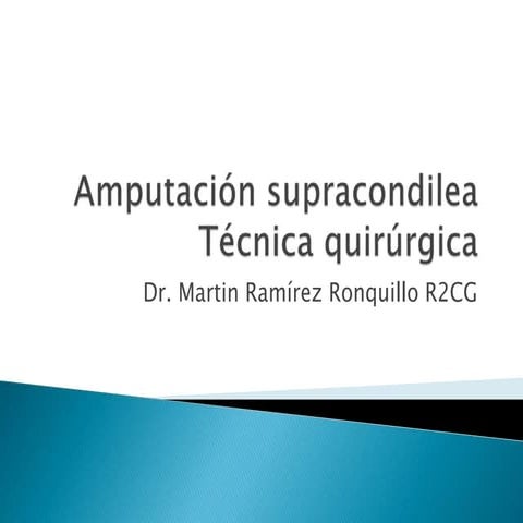 Apendicectomia Tipo Mc Burney | PPTX