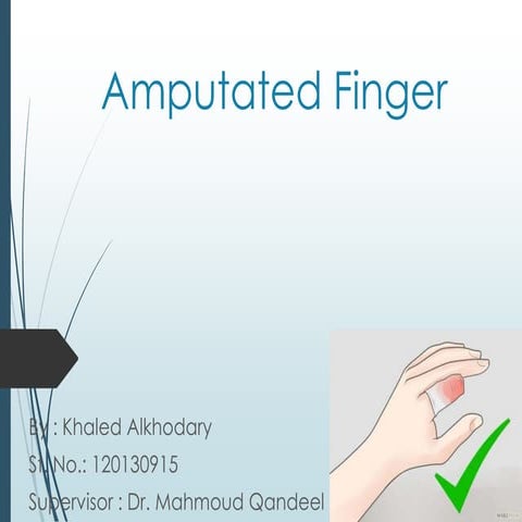 Amputated finger | PPTX