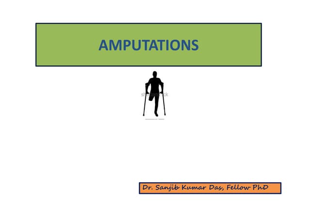 Amputation stump | PPTX
