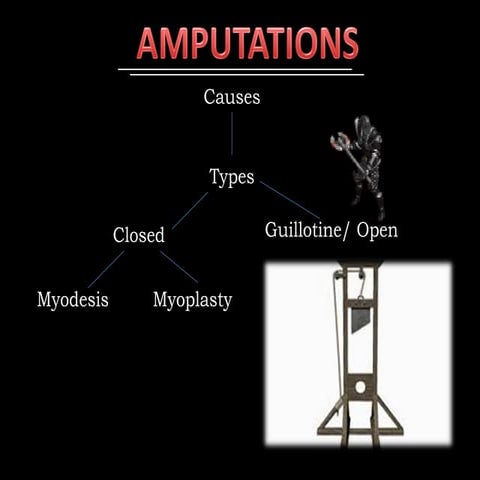 Amputations | PDF