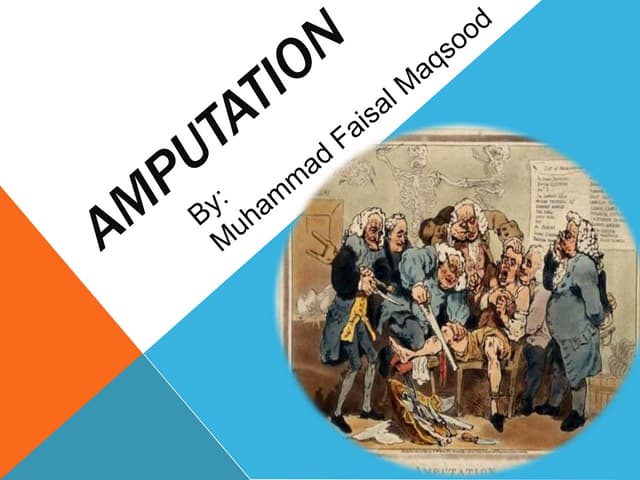 Amputation and disarticulation | PPTX