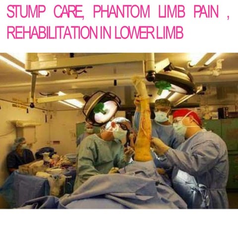amputation stump care phantom limb.pptx
