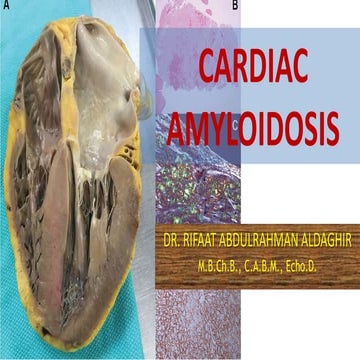 Amyloid .pptx