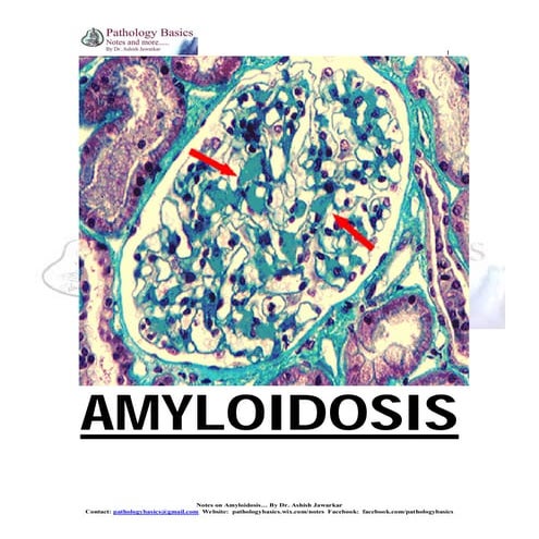 Metaplasia Pathology, Definition, Types, Causes and Examples | PPTX