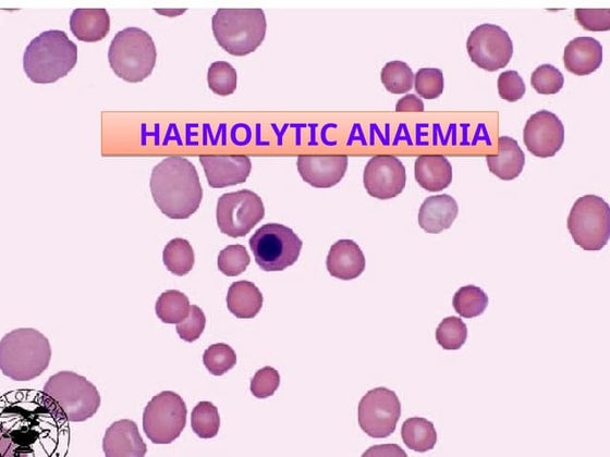 Hemolytic Anemia Algorithm Pdf