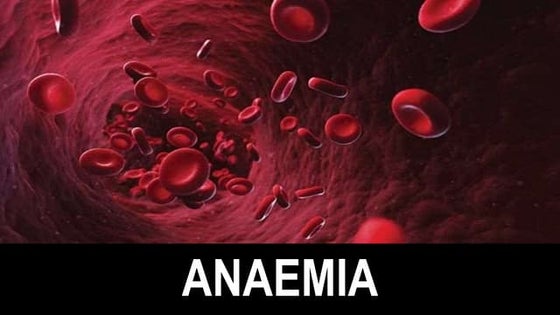 Types of anemia | PPT