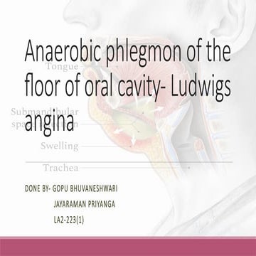 anaerobic phlegmon of floor of oral cavity | PPTX