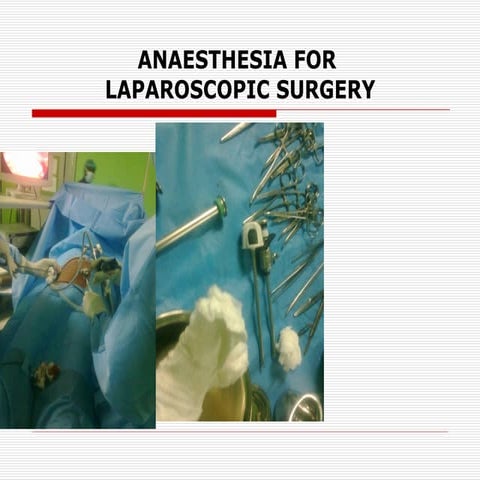 Anaesthesia for Laparoscopic surgeries and procedures | PPT
