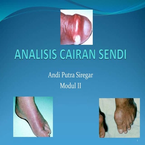 analisis cairan sendi modul.ppt