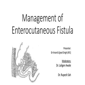 ENTEROCUTANEOUS FISTULA | PPT
