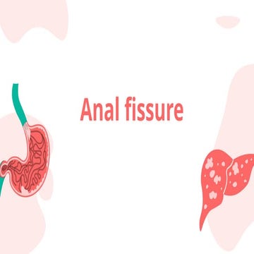 ananl fissure for under graduate medical.pptx