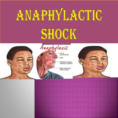 anaphylactic shock and its various types pdf | PDF | First Aid | Injuries