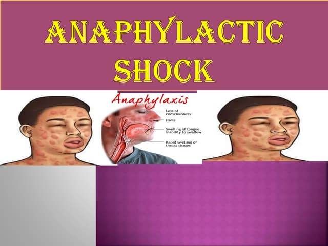 Emergency management of anaphylactic shock | PPTX | Lung and Respiratory Health | Diseases and ...