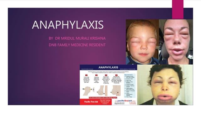 Emergency management of anaphylactic shock | PPTX | Lung and ...