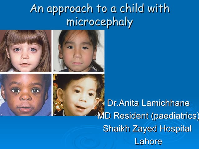 Approach to Macrocephaly / large head, Megalencephaly, Causes(Etiology ...