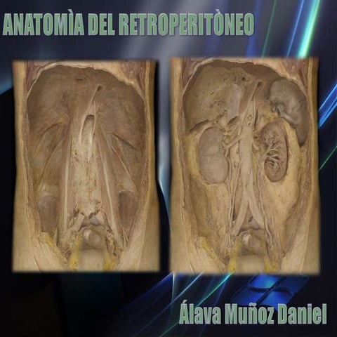 Anatomia del retroperitoneo; sus limites y contenido | PPTX