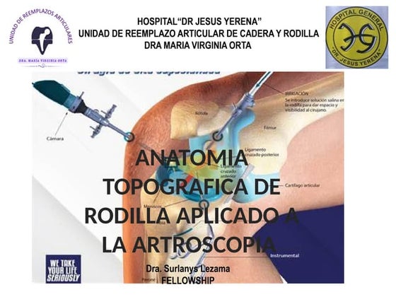 VASCULARIZACION DEL MIEMBRO IN hdlFERIOR.pptx