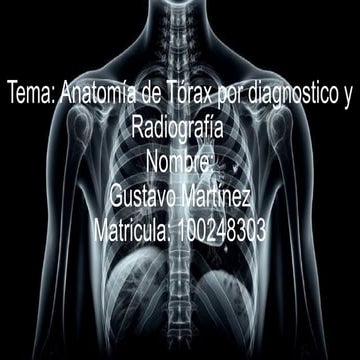 Anatomía de tórax por Diagnostico y Radiografia.pptx