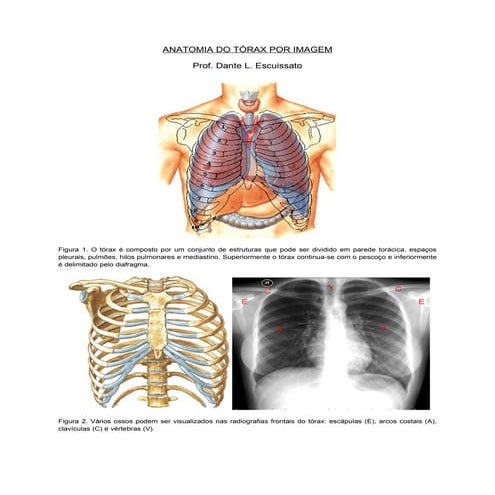 Anatomia tomografica do torax | PDF