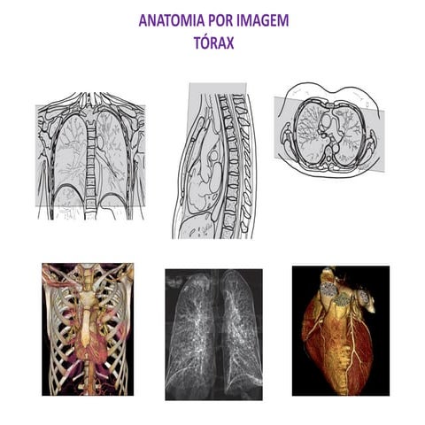 Anatomia Tórax TC RM | PPT