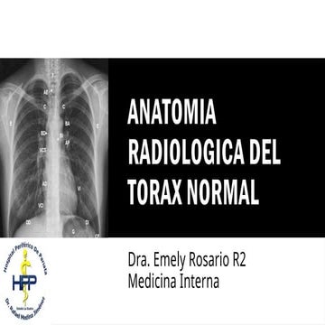 ANATOMIA RADIOLOGICA DE TORAX NORMAL.pptx