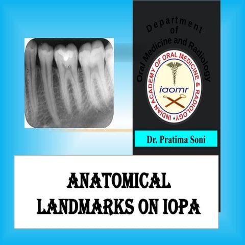 Anatomical landmarks in Periapical and Orthopantomogram X-ray | PPTX
