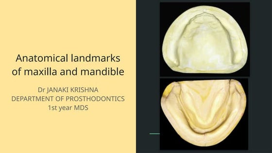 anatomic landmarks of the maxilla and mandible | PPTX | Ear, Nose and ...