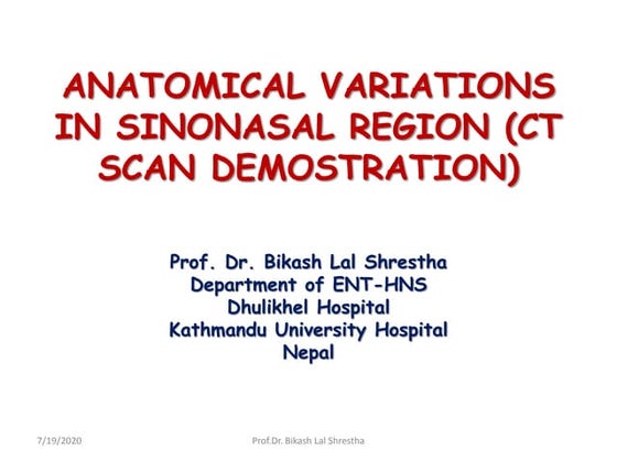 All about uncinate process of nose and paranasal sinuses | PPTX