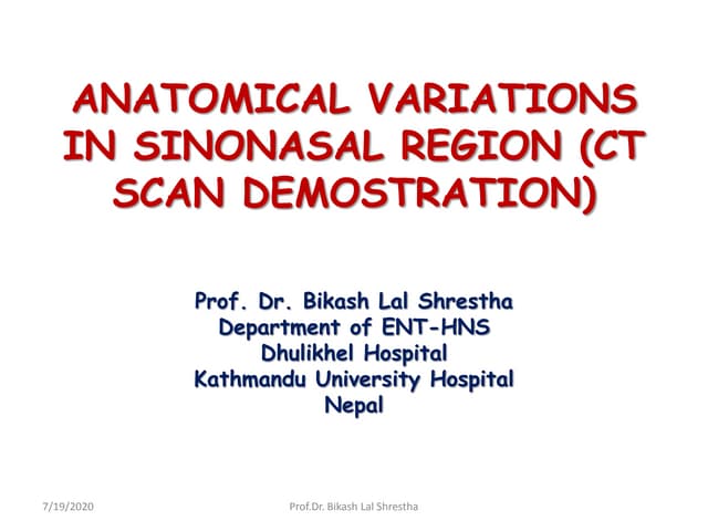 All about uncinate process of nose and paranasal sinuses | PPTX