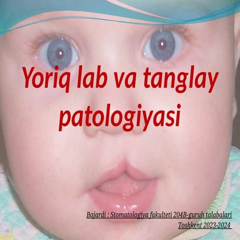 Anatomiya Lab-tanglay anomaliyasi. Ularda kuzatiladigan patologiyalar ...