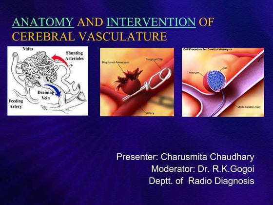 Anterior cerebral circulation | PPTX