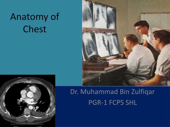 Ct chest anatomy | PPTX