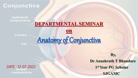 Anatomy of conjunctiva | PPTX | Eye and Vision Conditions | Diseases ...