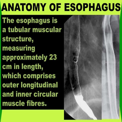Anatomy of esophagus | PPTX