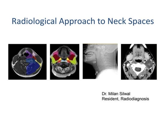 Ct Neck Anatomy Ppt The Radiology Assistant : Anatomy And Pathology Of