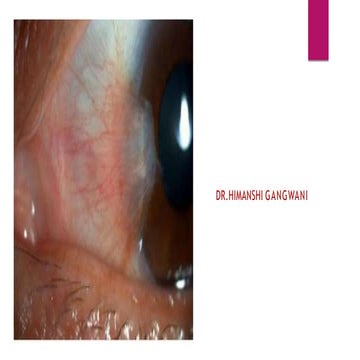 Anatomy of Pterygium.pptx