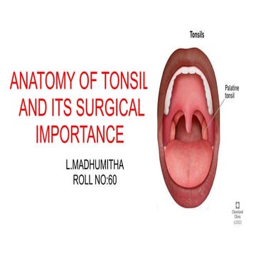 ANATOMY OF TONSIL AND ITS SURGICAL IMPORTANCE.pptx